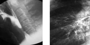 Radiografia da Hipofaringe, Saiba Tudo Sobre o Exame